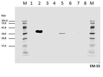 CD3 zeta [p Tyr111] Antibody (EM-55) - BSA Free (NBP2-37709): Novus ...